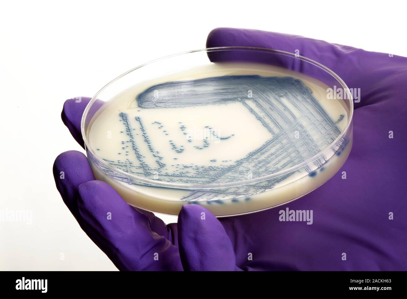 Colonies of MRSA (Methicillin-resistant Staphylococcus aureus) bacteria ...