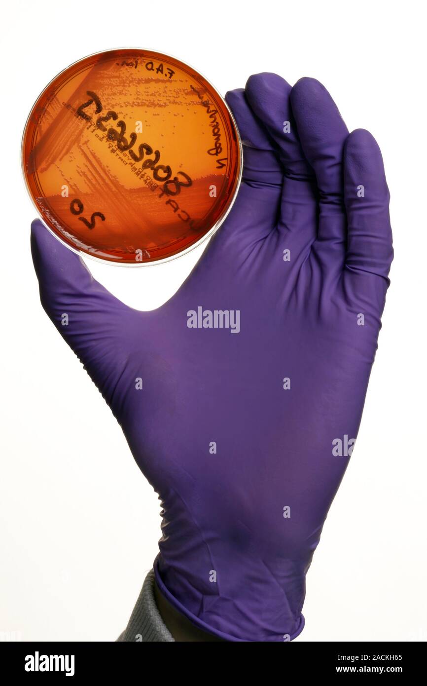 Gonococcus Structure Disease That Causes Neisseria