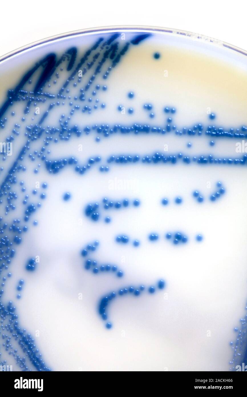 Colonies of MRSA (Methicillin-resistant Staphylococcus aureus) bacteria ...