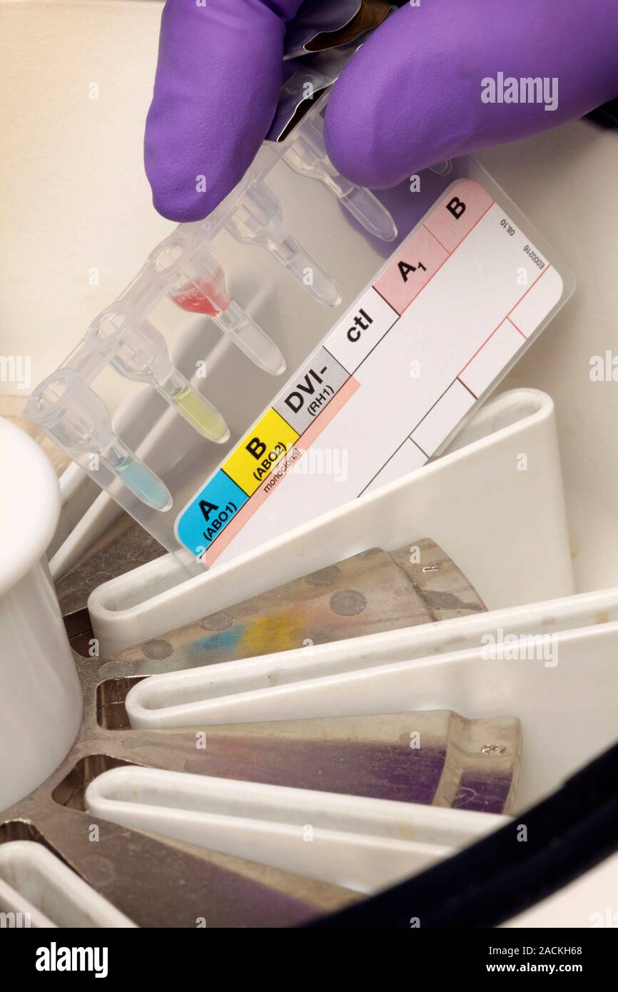 Gloved hand of a laboratory technician loads a Rhesus (Rh) test to ...