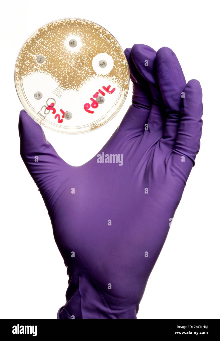 Yellow colonies of MRSA (Methicillin-resistant Staphylococcus aureus ...