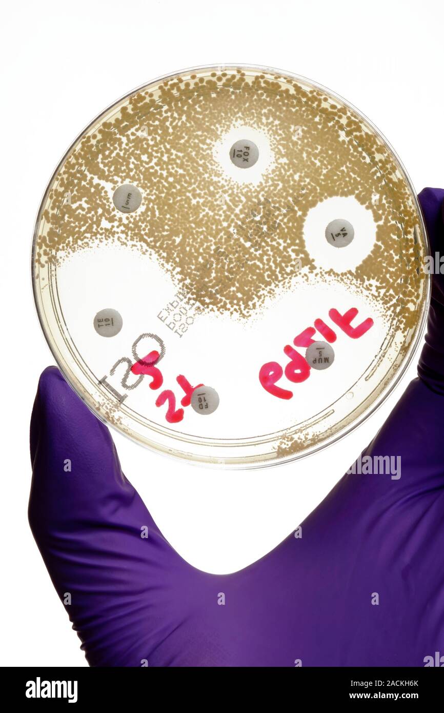 Yellow colonies of MRSA (Methicillin-resistant Staphylococcus aureus ...