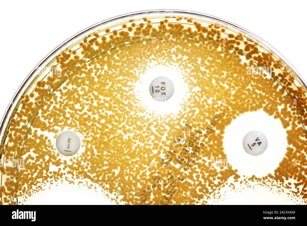 Yellow colonies of MRSA (Methicillin-resistant Staphylococcus aureus ...