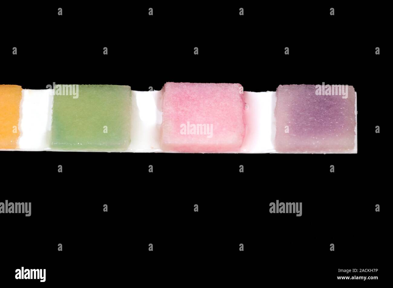 Multiple test stick (multistix) dipped in the urine of a patient with ...
