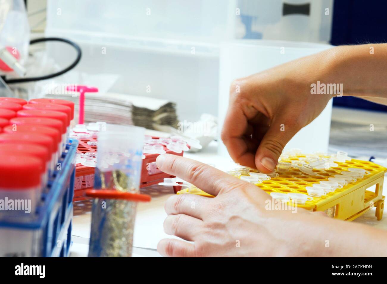 Hands of a scientist prepares a tray of eppendorf sample tubes for ...