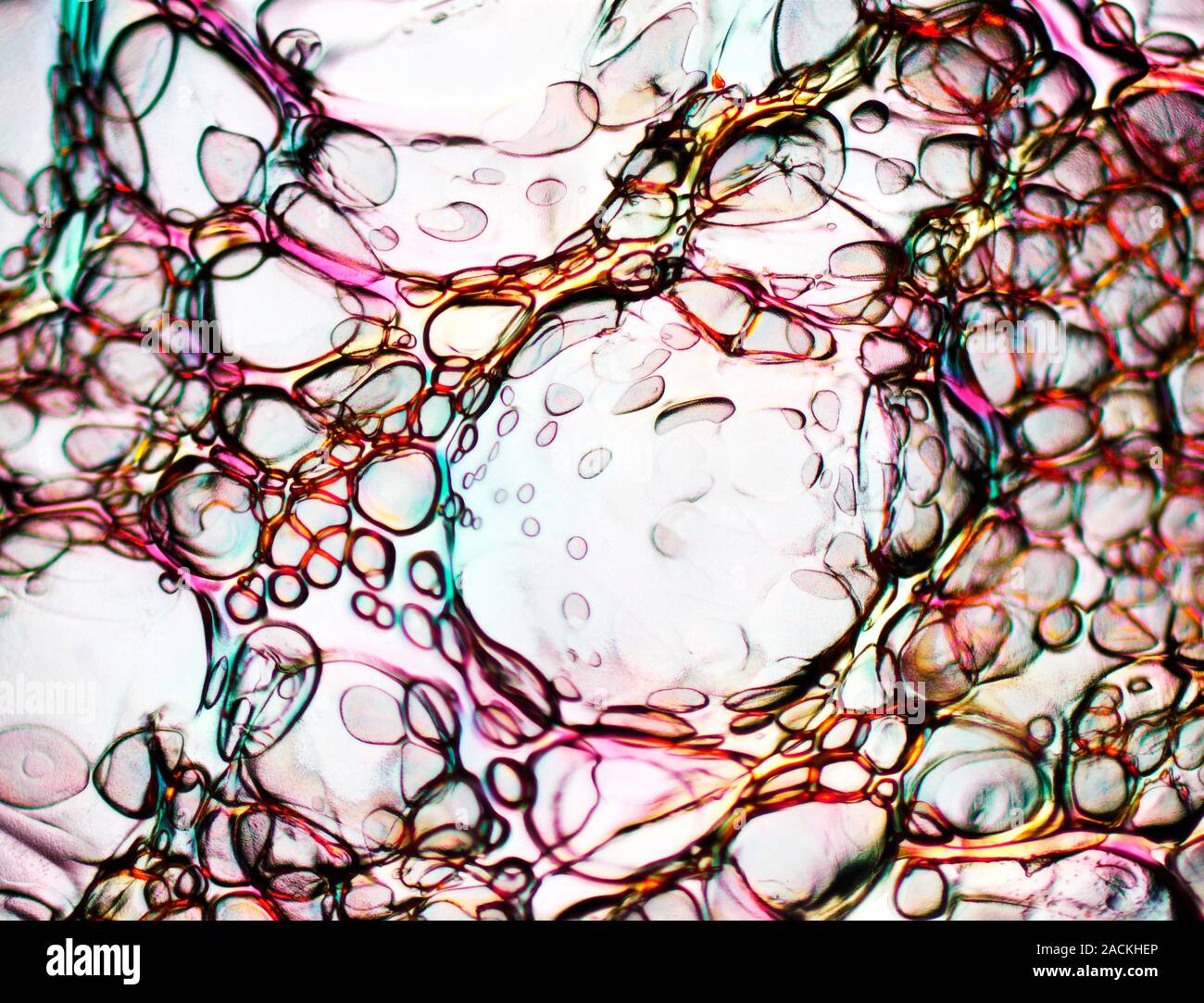 Egg white, light micrograph. Magnification 50X Stock Photo - Alamy