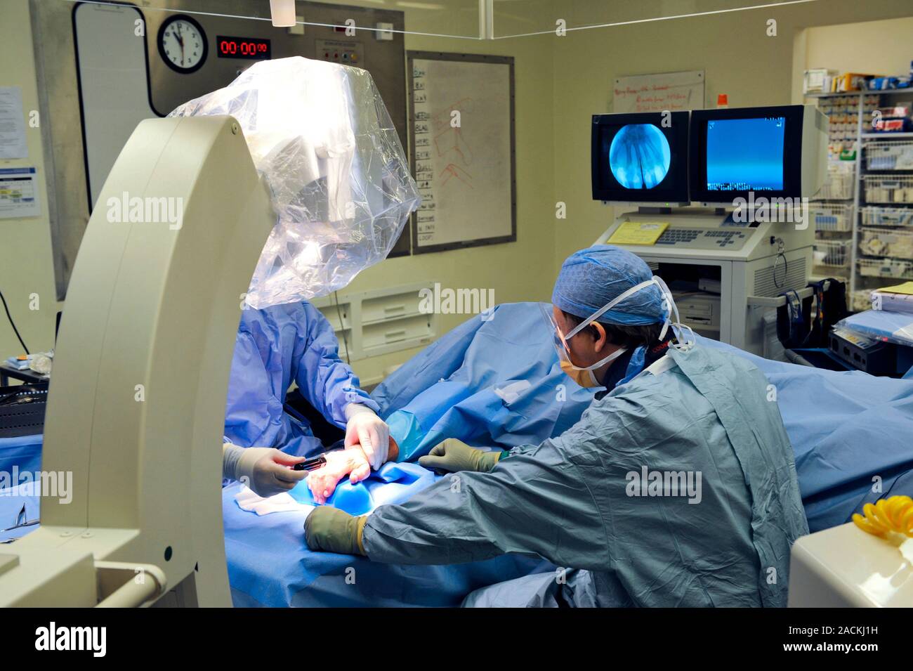 Knuckle joint replacement surgery. Orthopaedic surgeons carrying out a ...