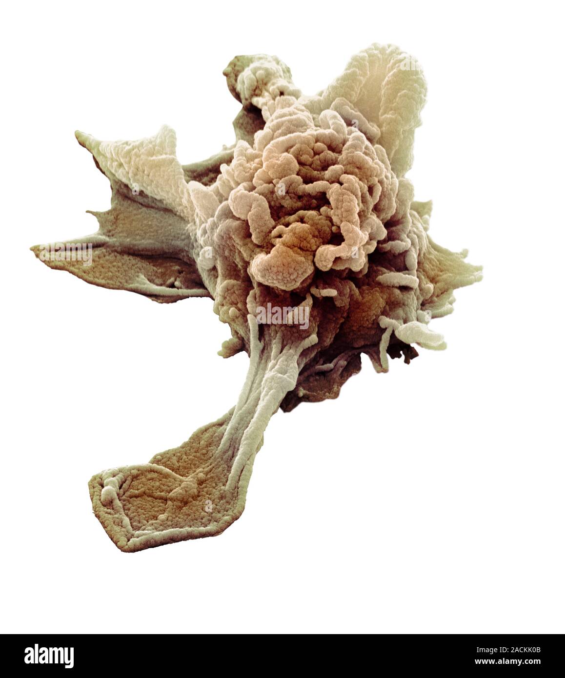 Activated granulocyte. Coloured scanning electron micrograph (SEM) of ...