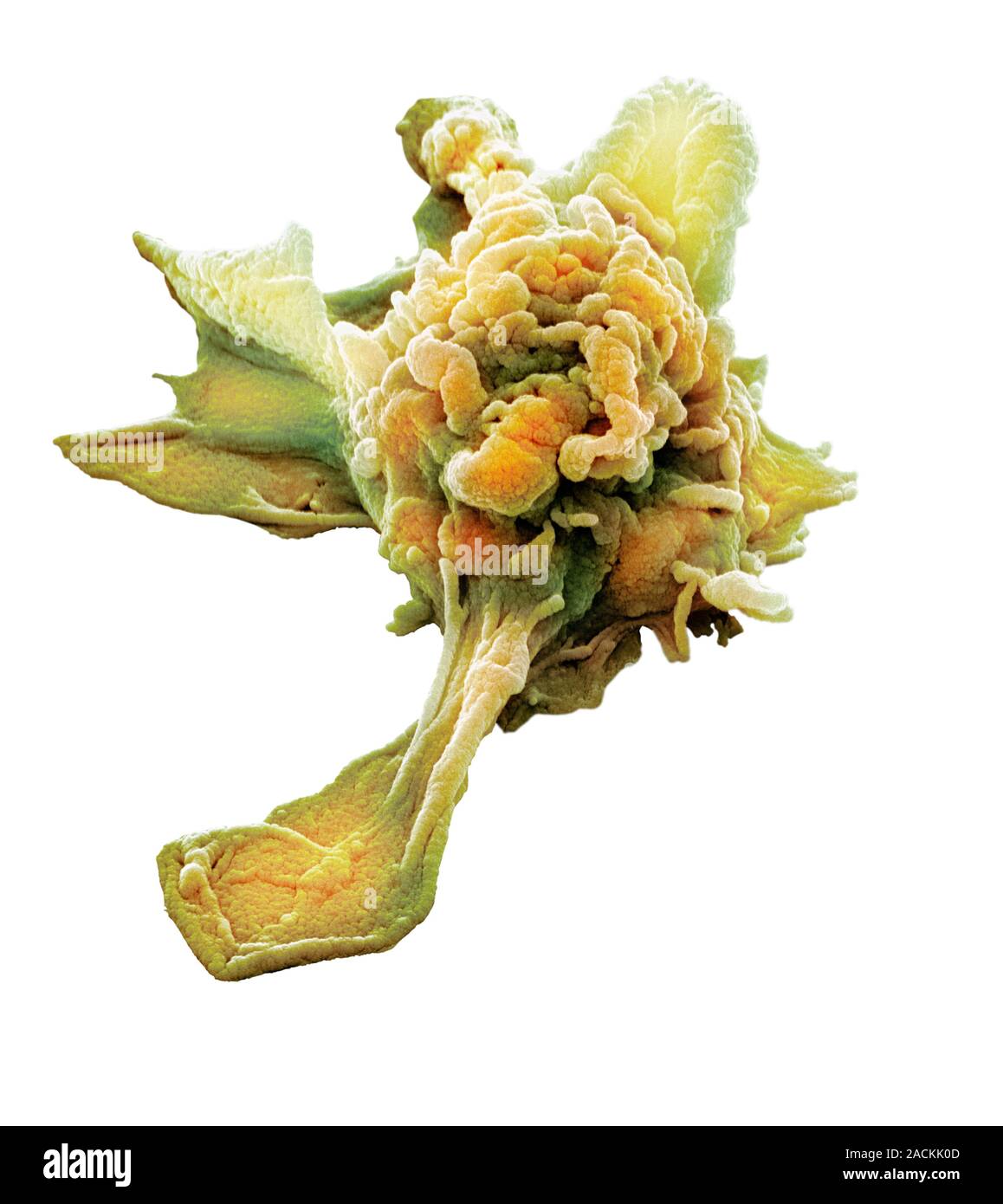 Activated granulocyte. Coloured scanning electron micrograph (SEM) of ...