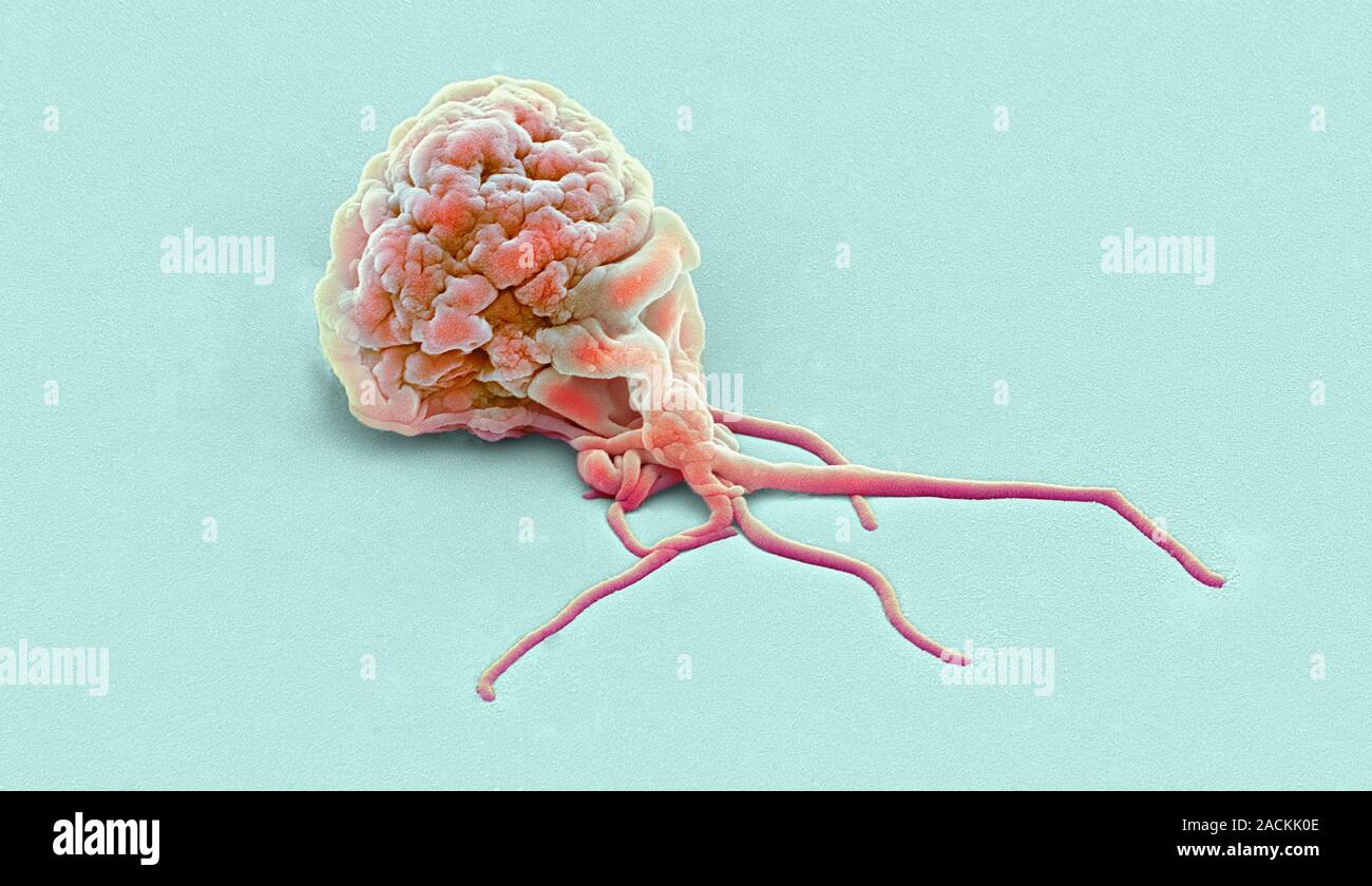 Activated granulocyte. Coloured scanning electron micrograph (SEM) of ...