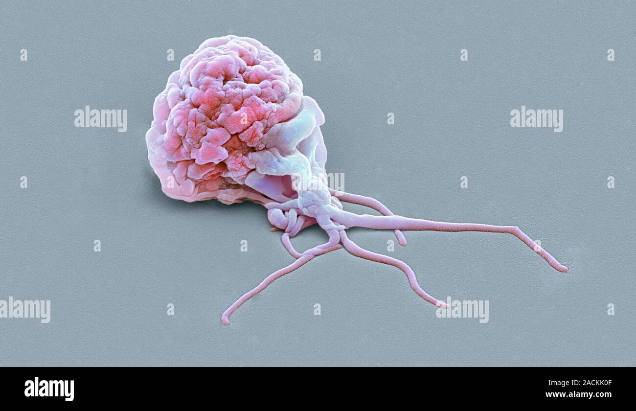 Activated granulocyte. Coloured scanning electron micrograph (SEM) of ...