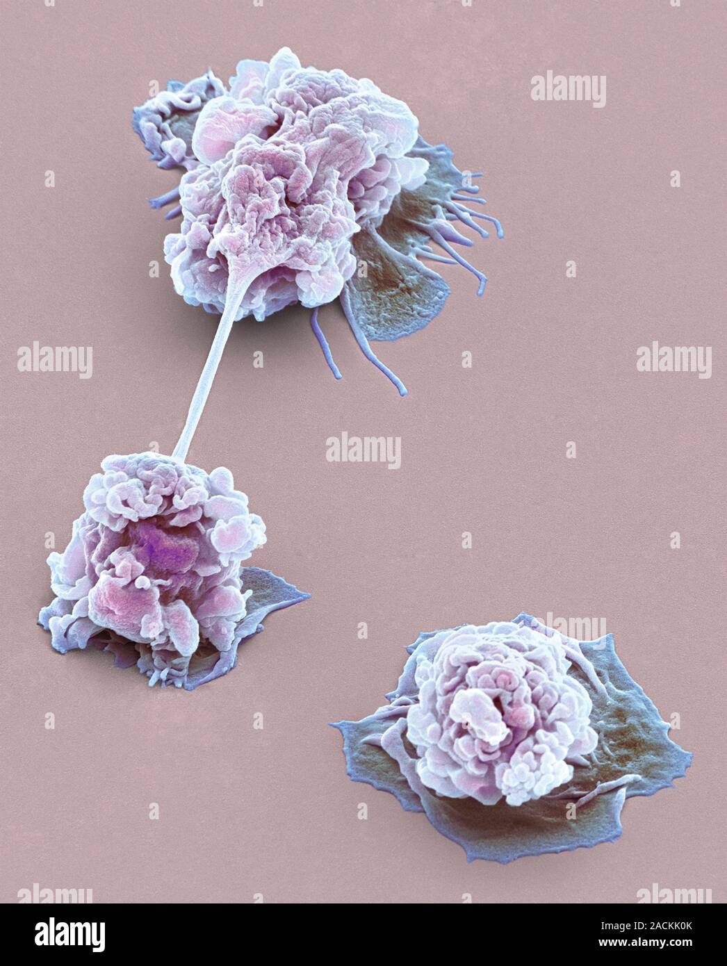 Activated granulocytes. Coloured scanning electron micrograph (SEM) of ...