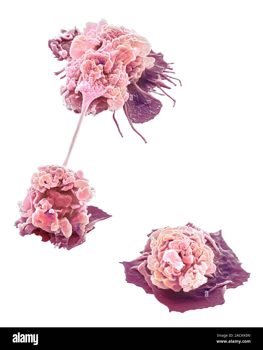 Activated granulocytes. Coloured scanning electron micrograph (SEM) of ...