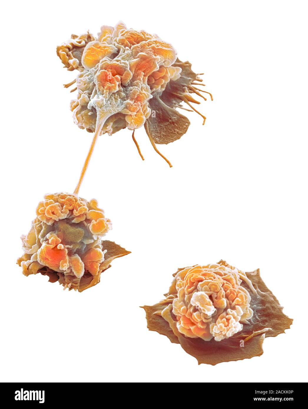 Activated granulocytes. Coloured scanning electron micrograph (SEM) of ...