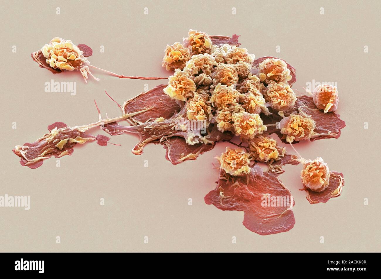 Activated granulocytes. Coloured scanning electron micrograph (SEM) of ...