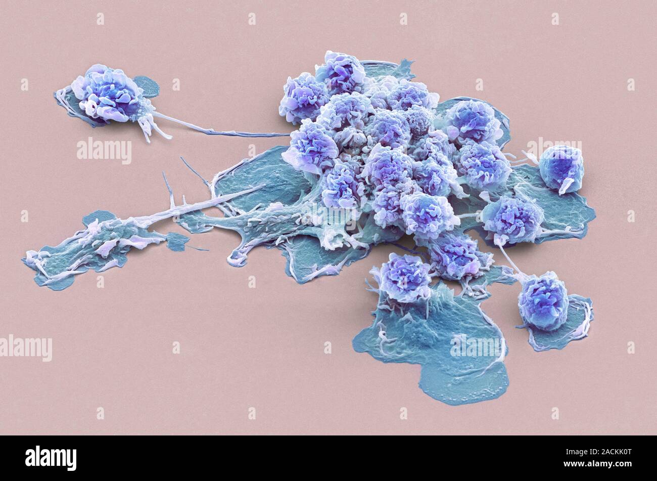 Activated granulocytes. Coloured scanning electron micrograph (SEM) of ...