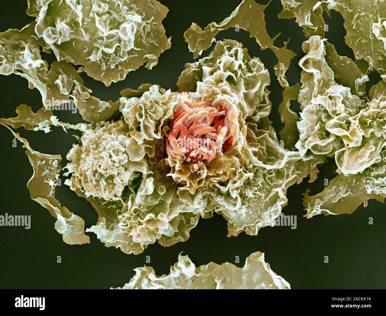 TB bacteria infecting macrophages. Coloured scanning electron micrograph (SEM) of Mycobacterium ...