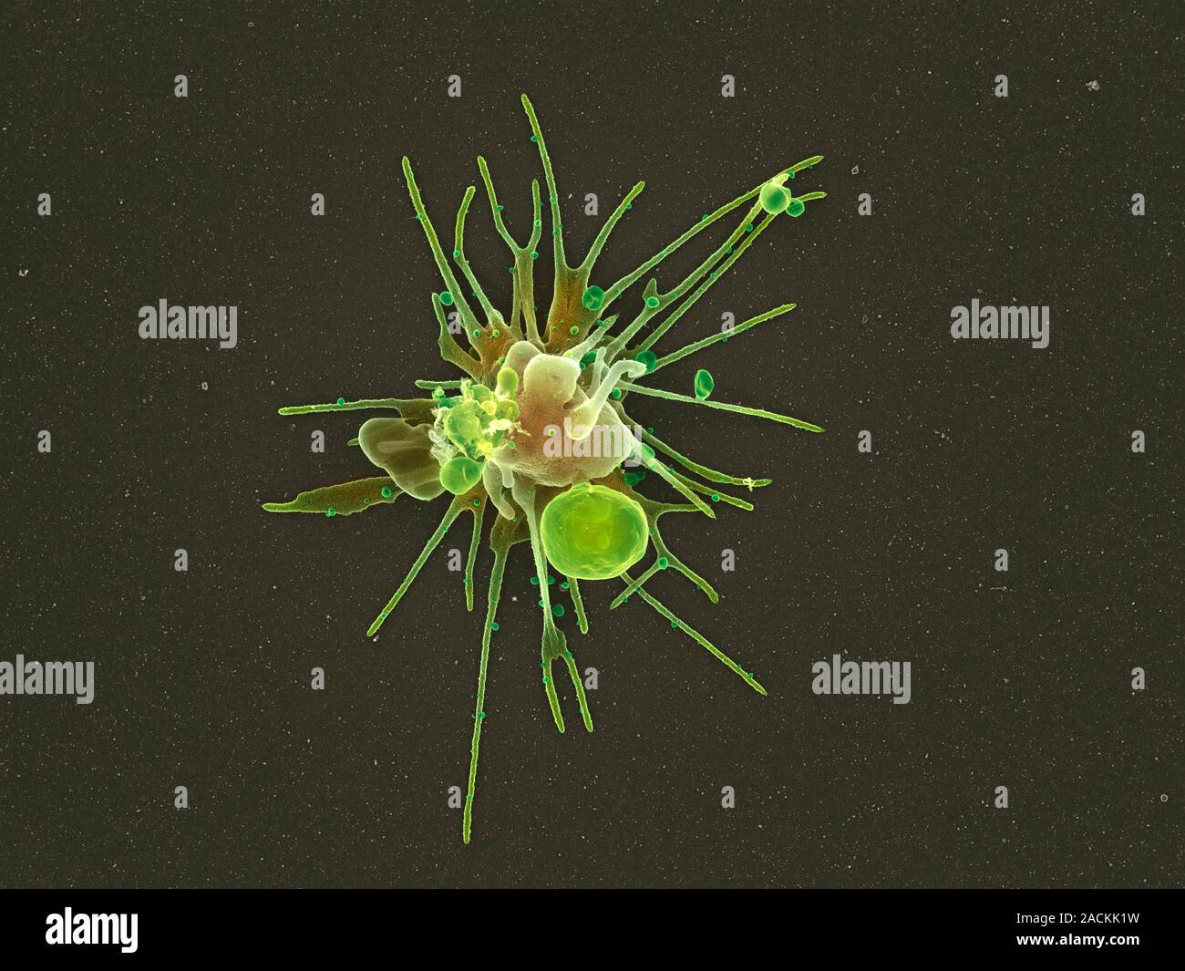 Activated platelet. Coloured scanning electron micrograph (SEM) of an ...