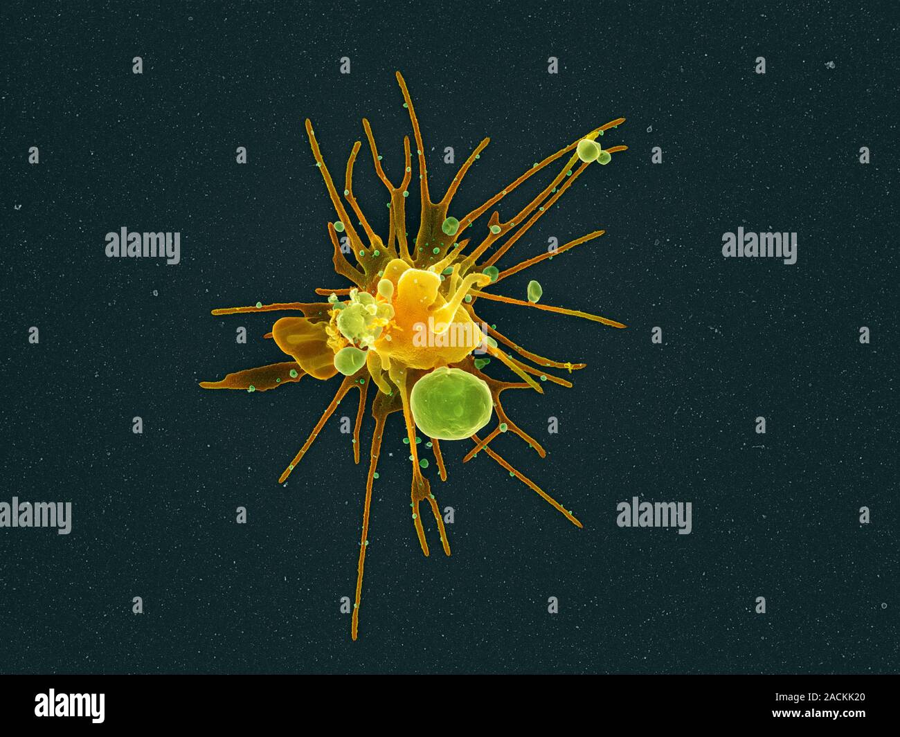 Activated platelet. Coloured scanning electron micrograph (SEM) of an ...