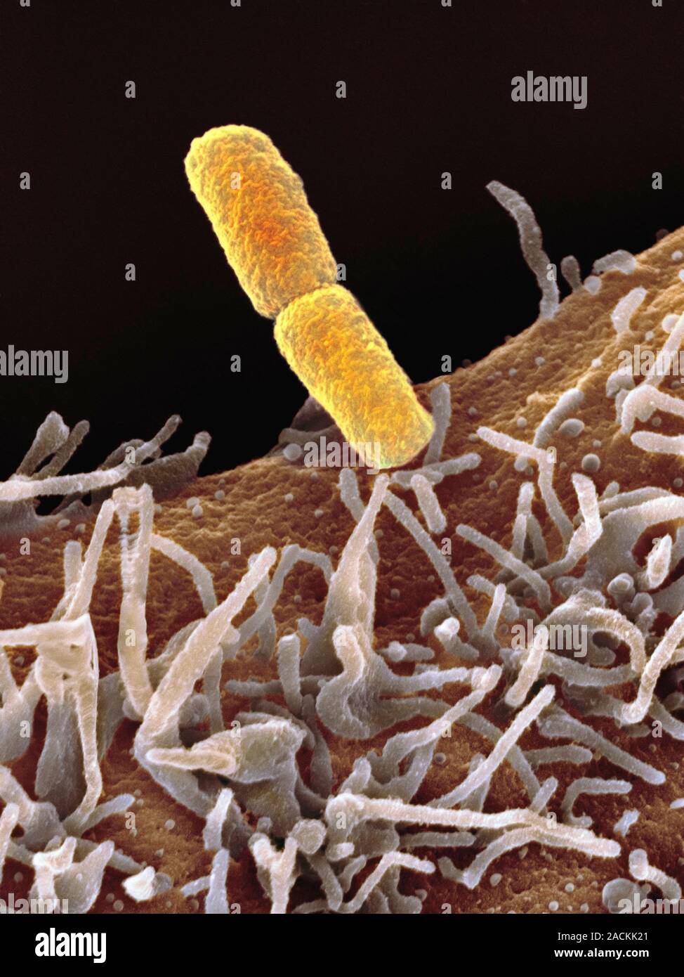Shigella bacteria. Scanning electron micrograph (SEM) of Shigella sp ...