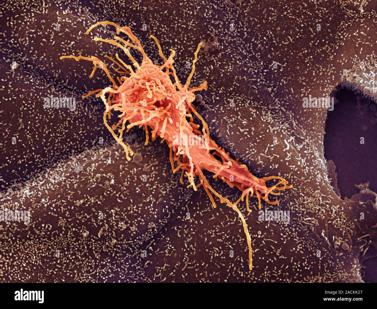 HeLa cell. Coloured scanning electron micrograph (SEM) of a cultured ...