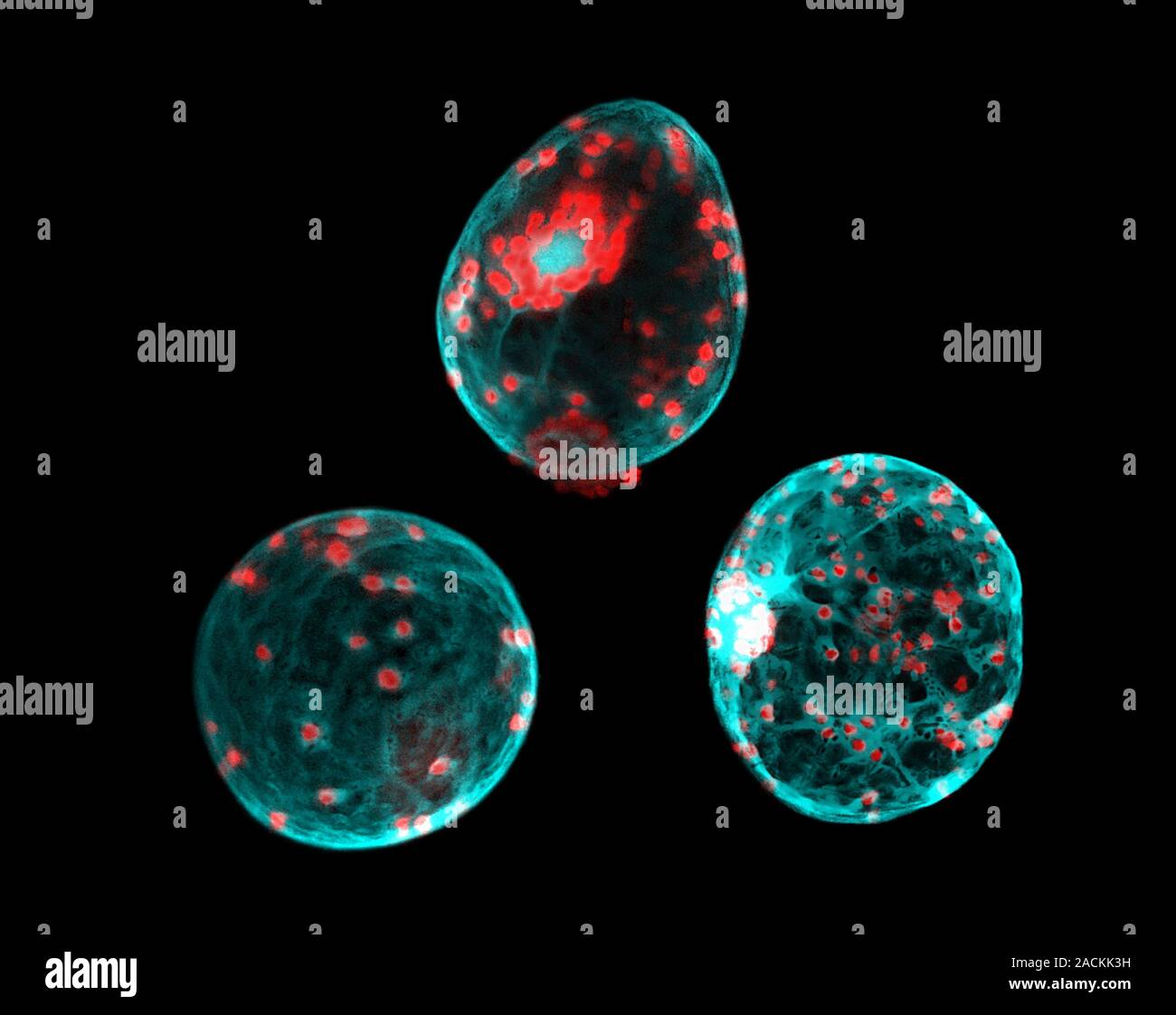 Cell protoplasts. Confocal micrograph of plant (Nicotiana benthamiana ...