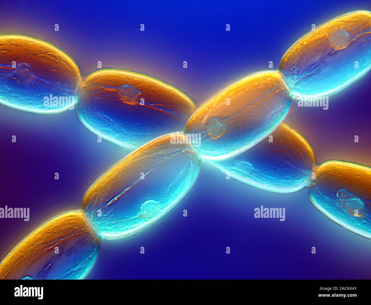 Stamen hairs, light micrograph. Stamen hairs of a Tradescantia flower ...