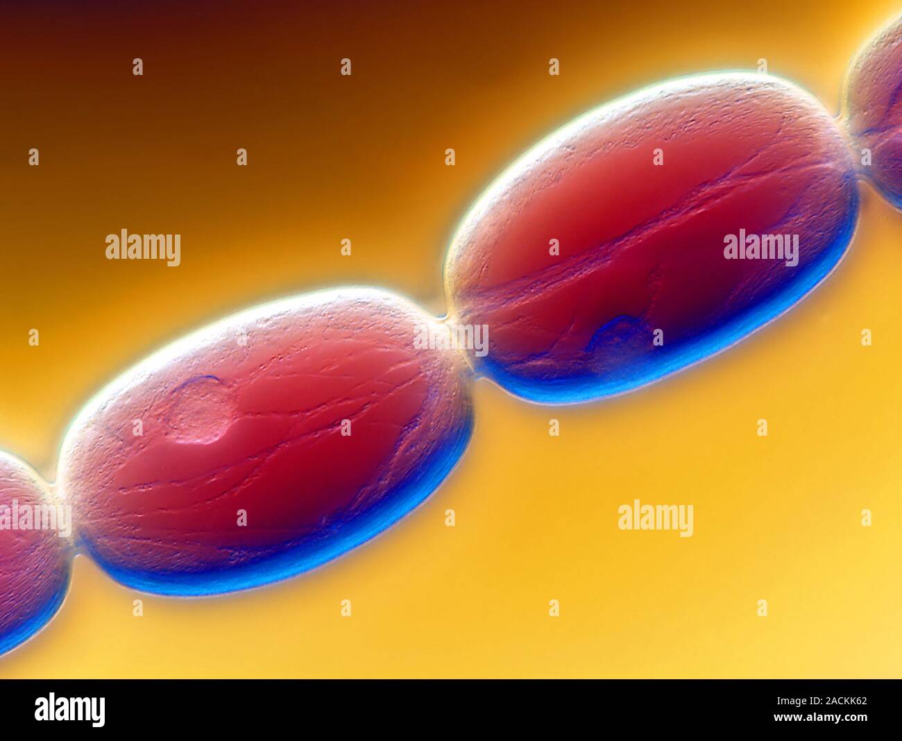 Stamen hairs, light micrograph. Stamen hairs of a Tradescantia flower ...