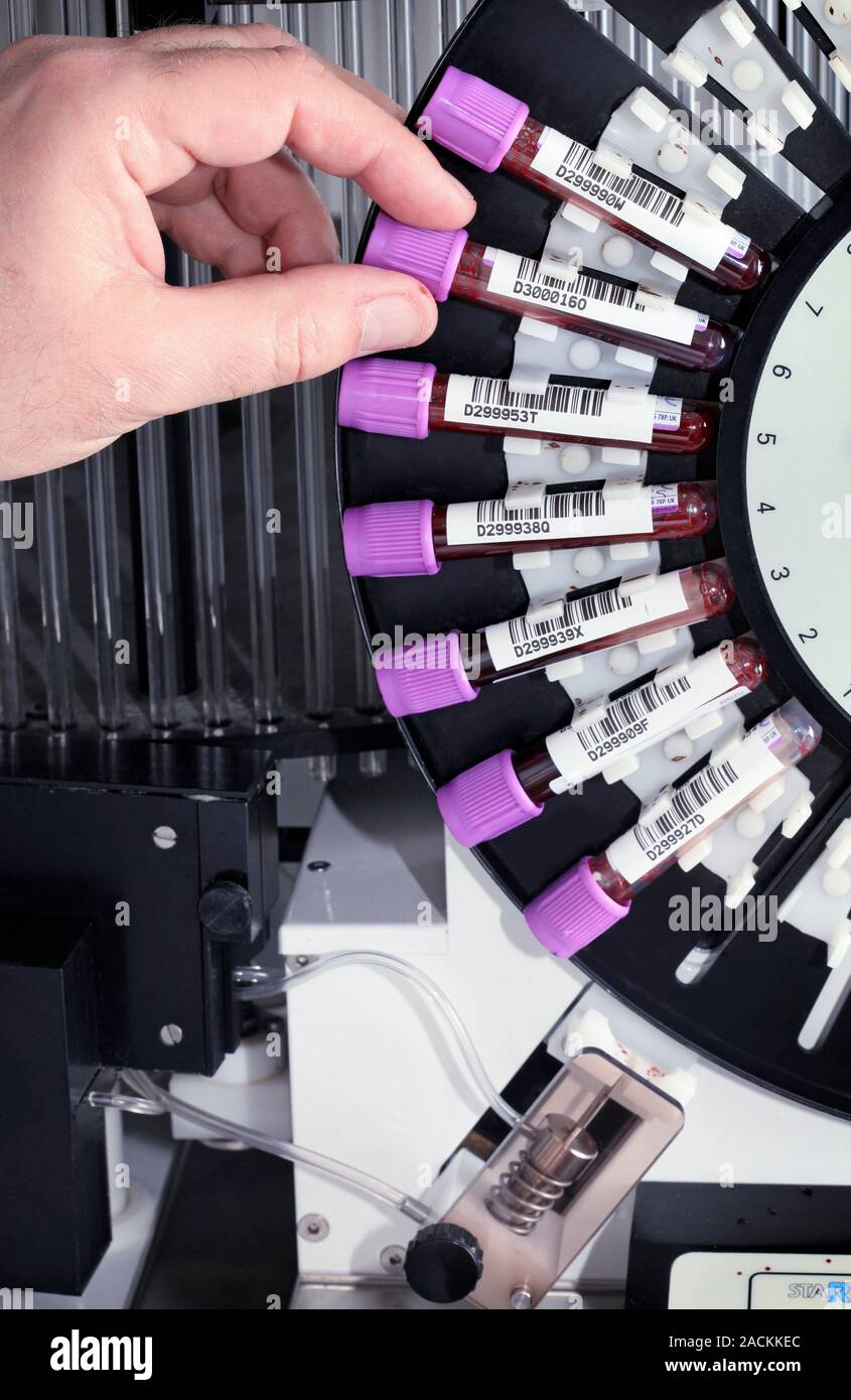 Automated erythrocyte (red blood cell) sedimentation analyser for blood ...