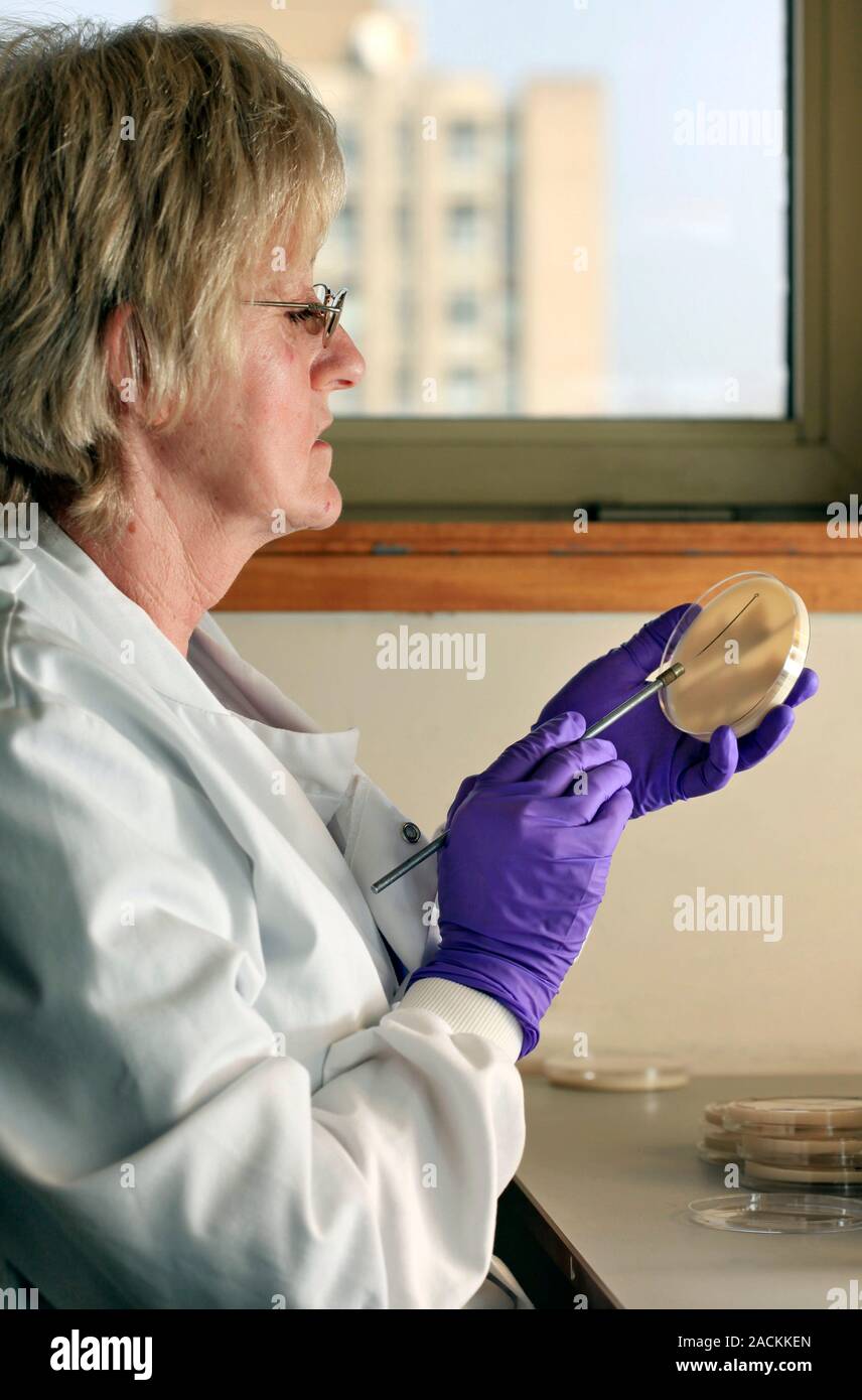 Female scientist plates a sample of urine onto agar in a petri dish to ...