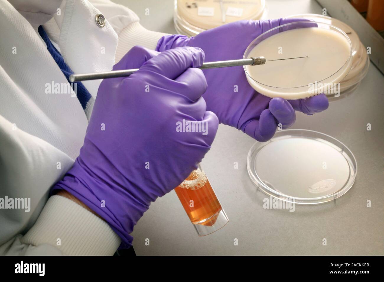 Gloved hands of a female scientist plates a sample of urine onto agar ...
