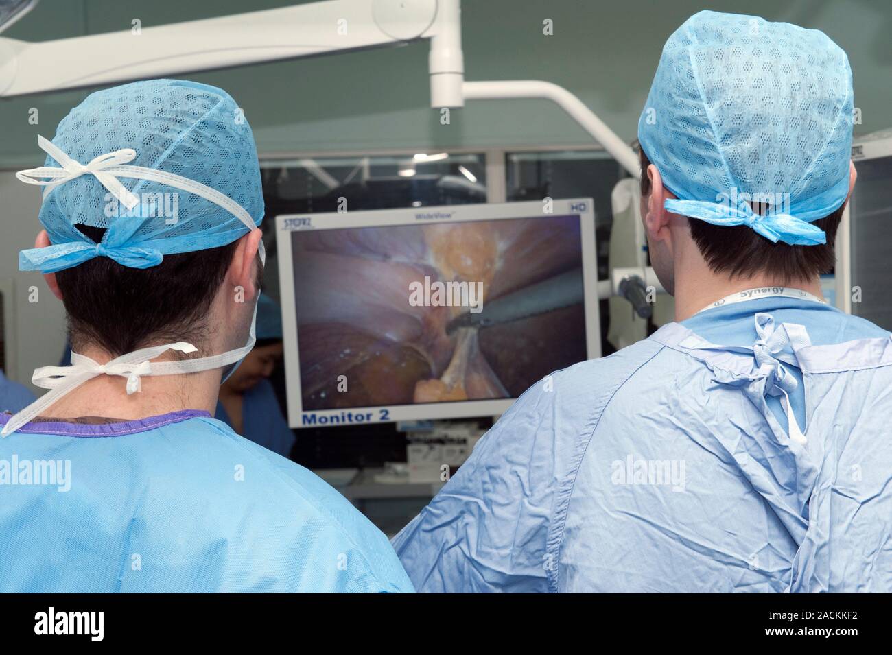 Surgeons in an operating theatre use a laparoscope (endoscope) seen on ...