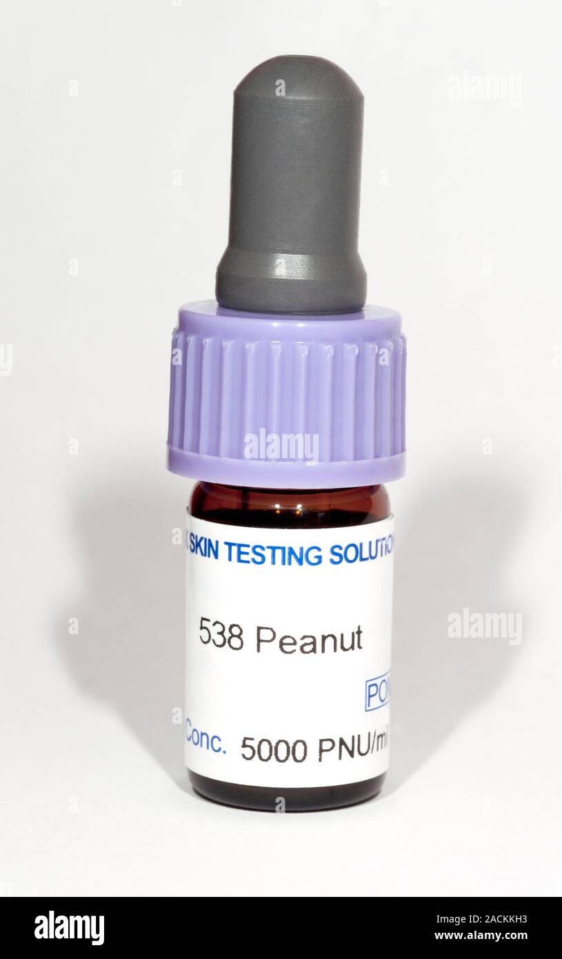 Bottle of peanut solution from a skin prick kit for testing allergies ...