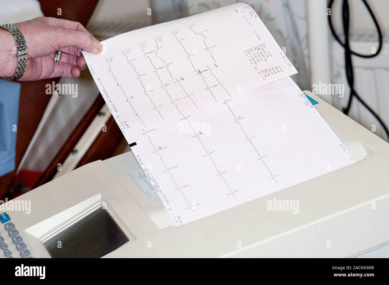 Electrocardiogram (ECG) printout of the electrical activity of the ...