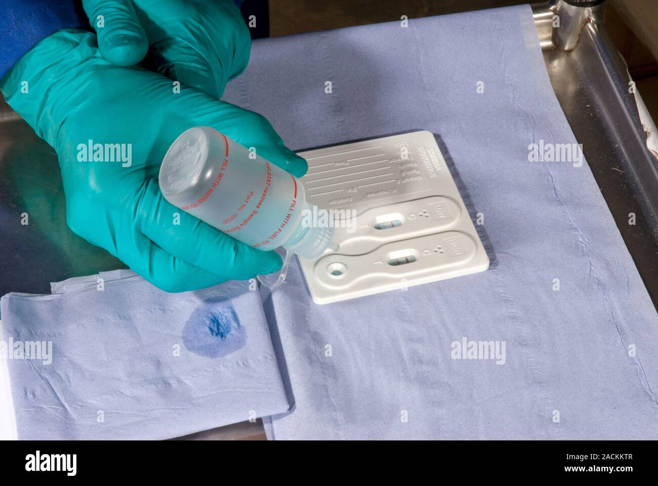 Fuel microbial contamination test. Researcher carrying out a test for ...