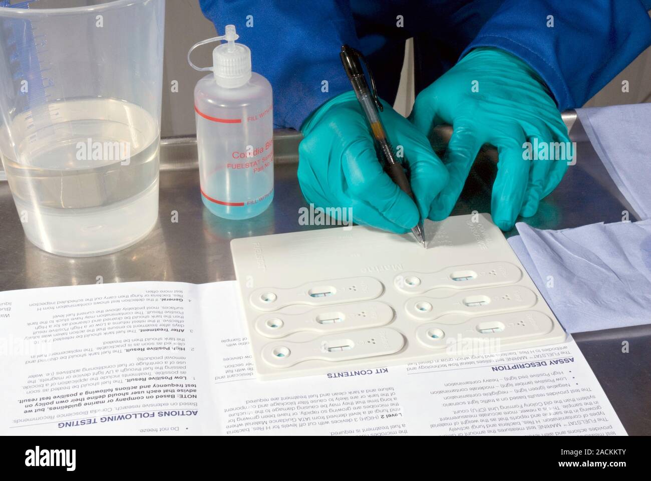 Fuel microbial contamination test. Researcher carrying out a test for ...