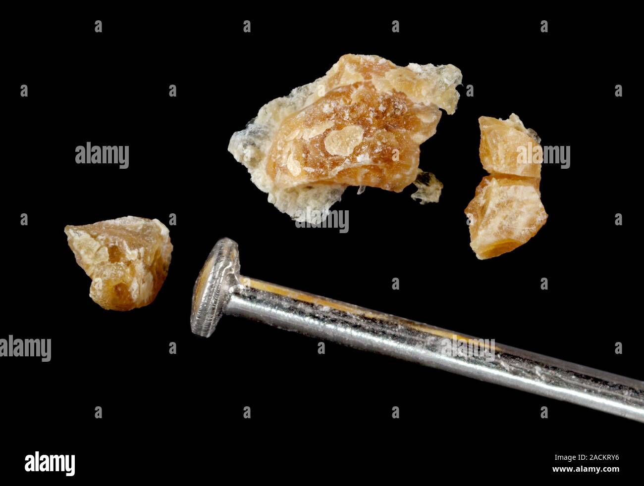 Smallpox scabs from 1867. These scabs are from the archives of the ...