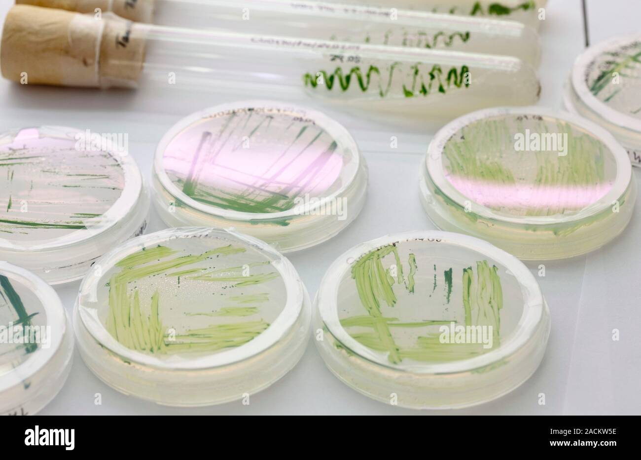 Microalgae food supplement production. Petri dishes containing cultured ...