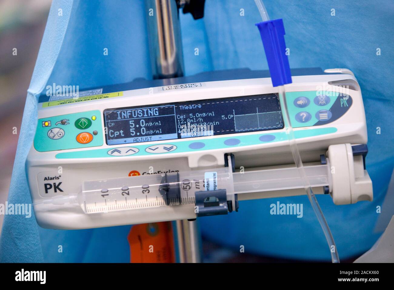 Drug infusion equipment attached to an intravenous (IV) drip in a ...