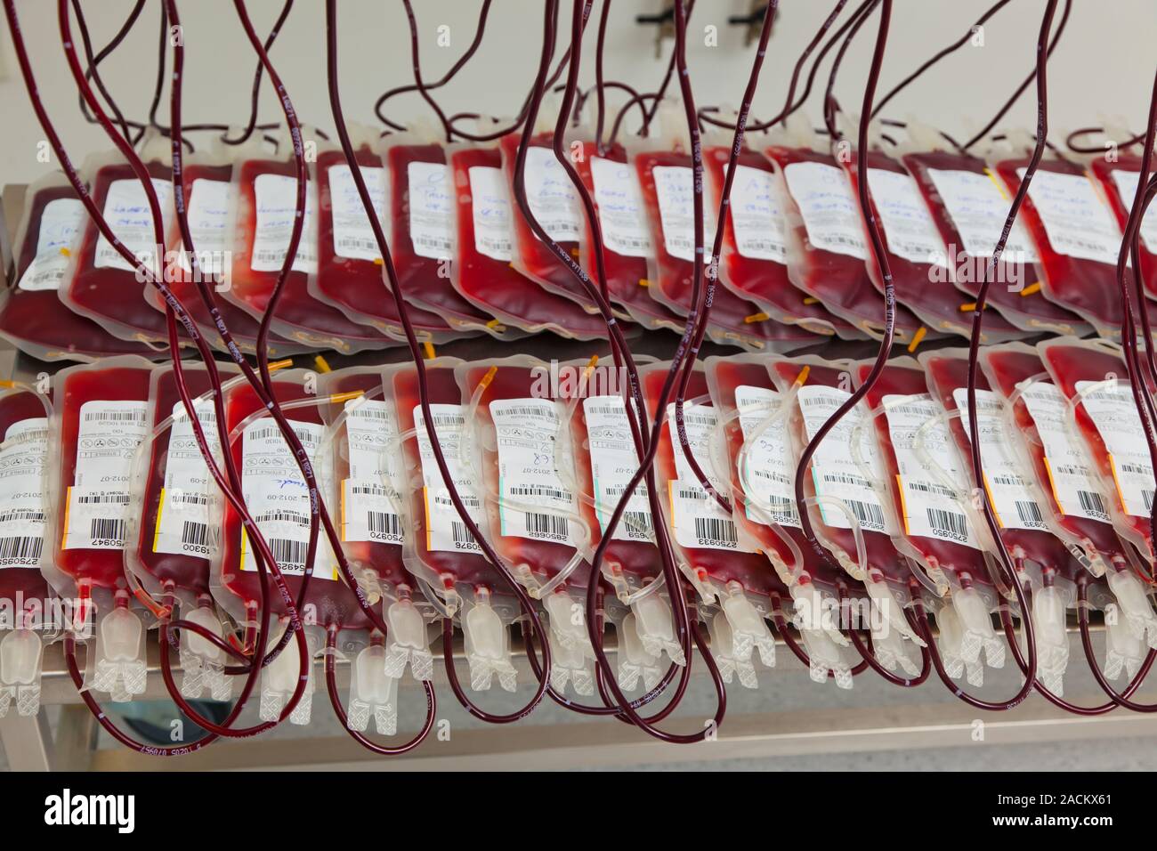 Blood from donated blood in the blood laboratory Stock Photo - Alamy