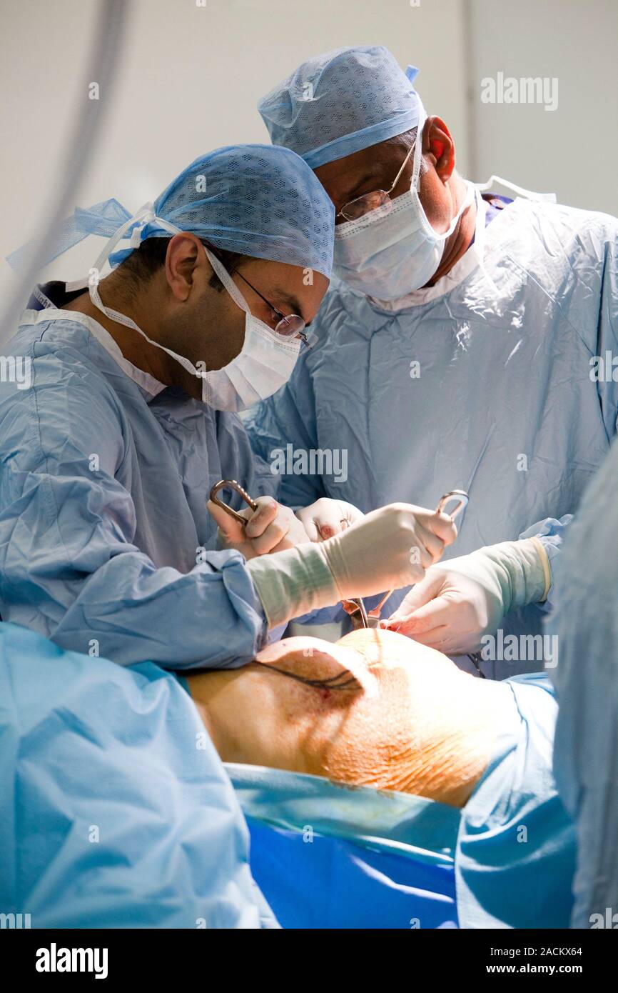 Surgeons performing surgery to repair an incisional hernia in a patient ...