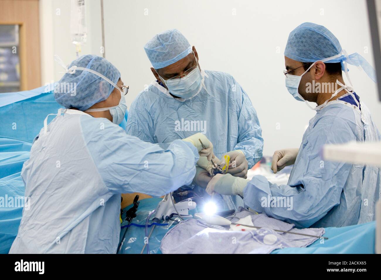 Surgical team performing surgery with a laparoscope (endoscope, with ...