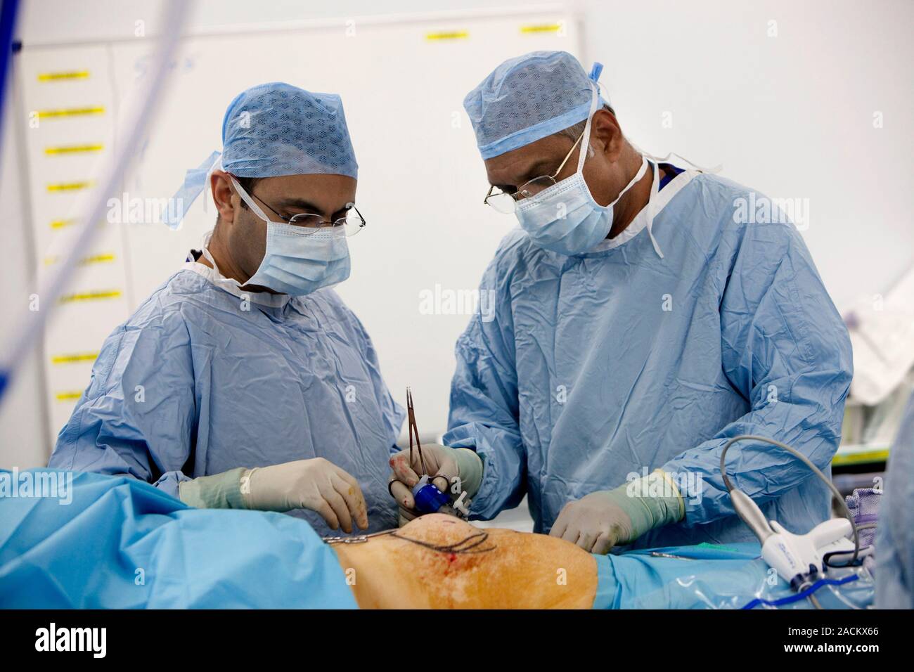 Surgeons performing surgery to repair an incisional hernia in a patient ...