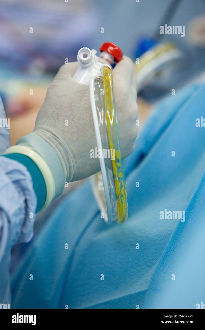 Gloved hand holds surgical equipment in a hospital operating theatre ...