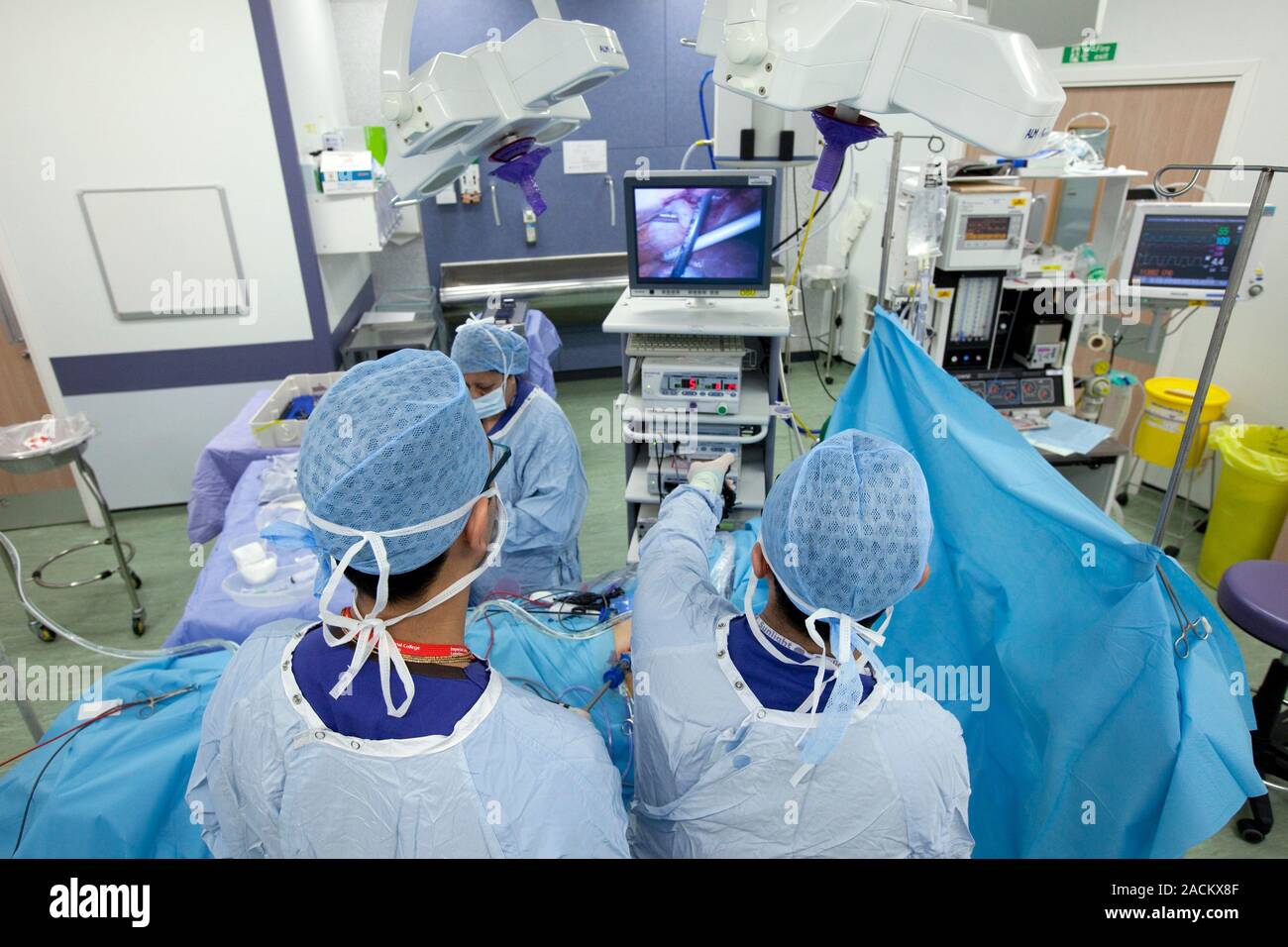 Surgeons using laparoscopes (endoscopes) and a screen monitor to remove ...
