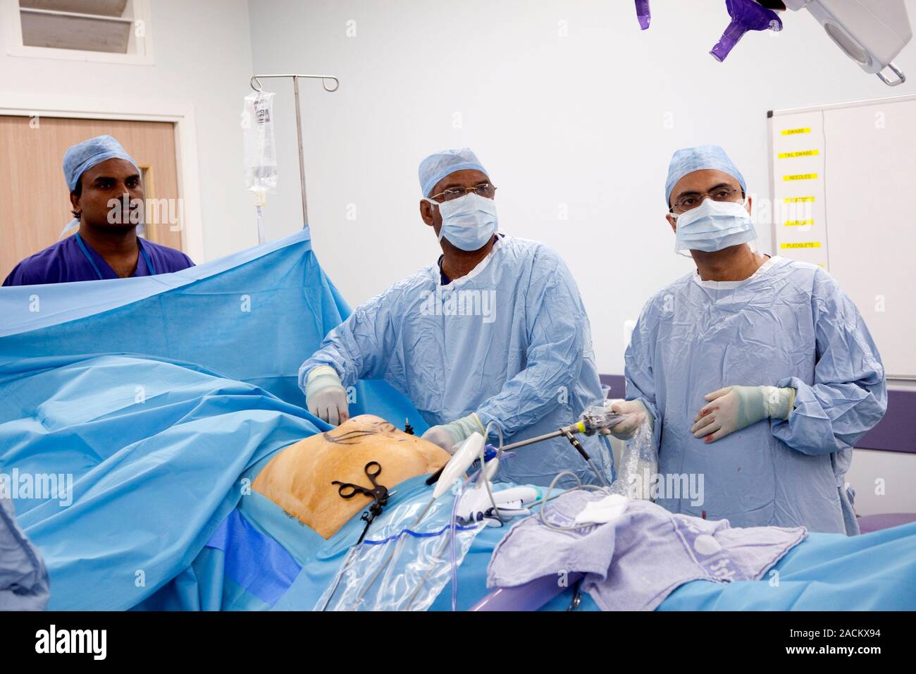 Surgeons using laparoscopes (endoscopes) to repair an incisional hernia ...