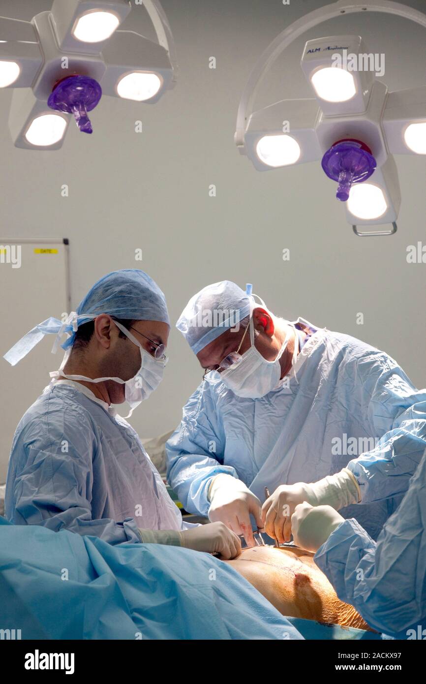 Surgeons repairing an incisional hernia in the abdomen of a patient in ...