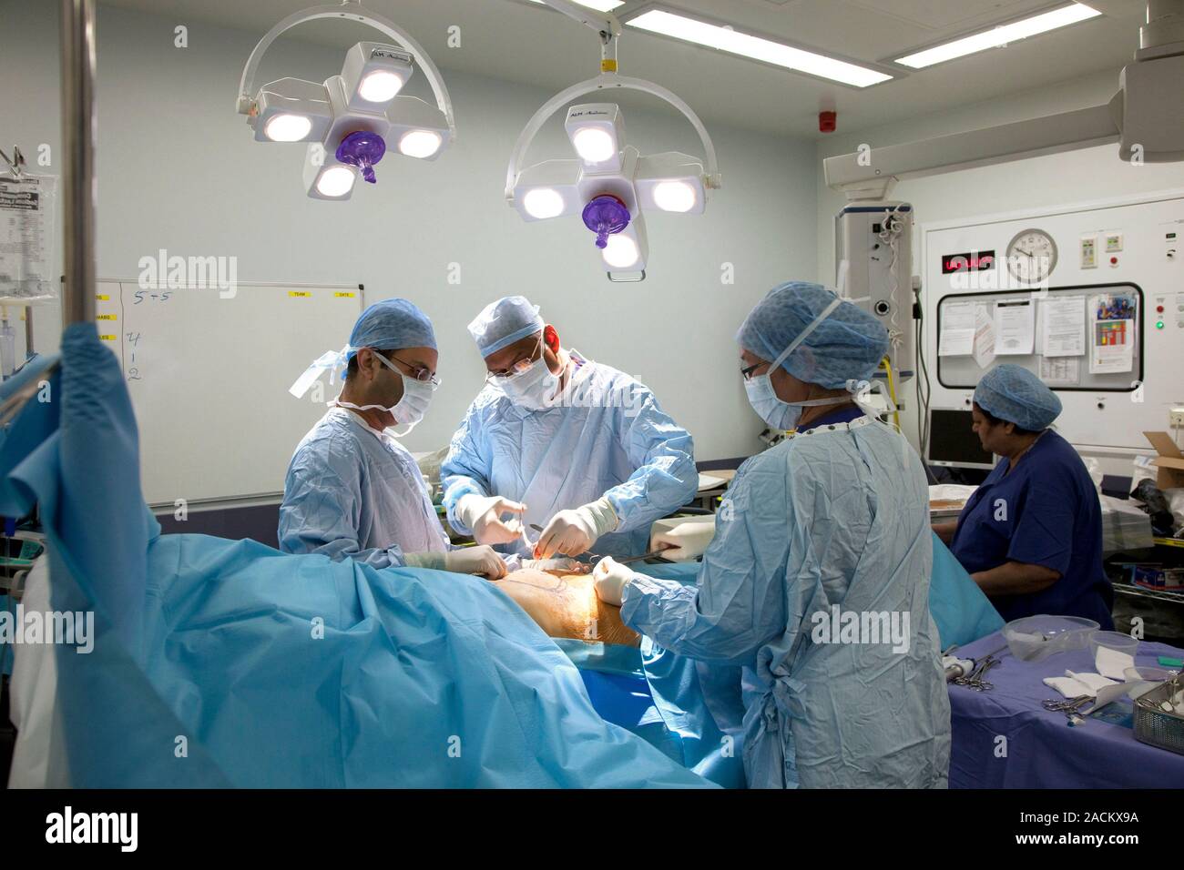 Surgeons repairing an incisional hernia in the abdomen of a patient in ...
