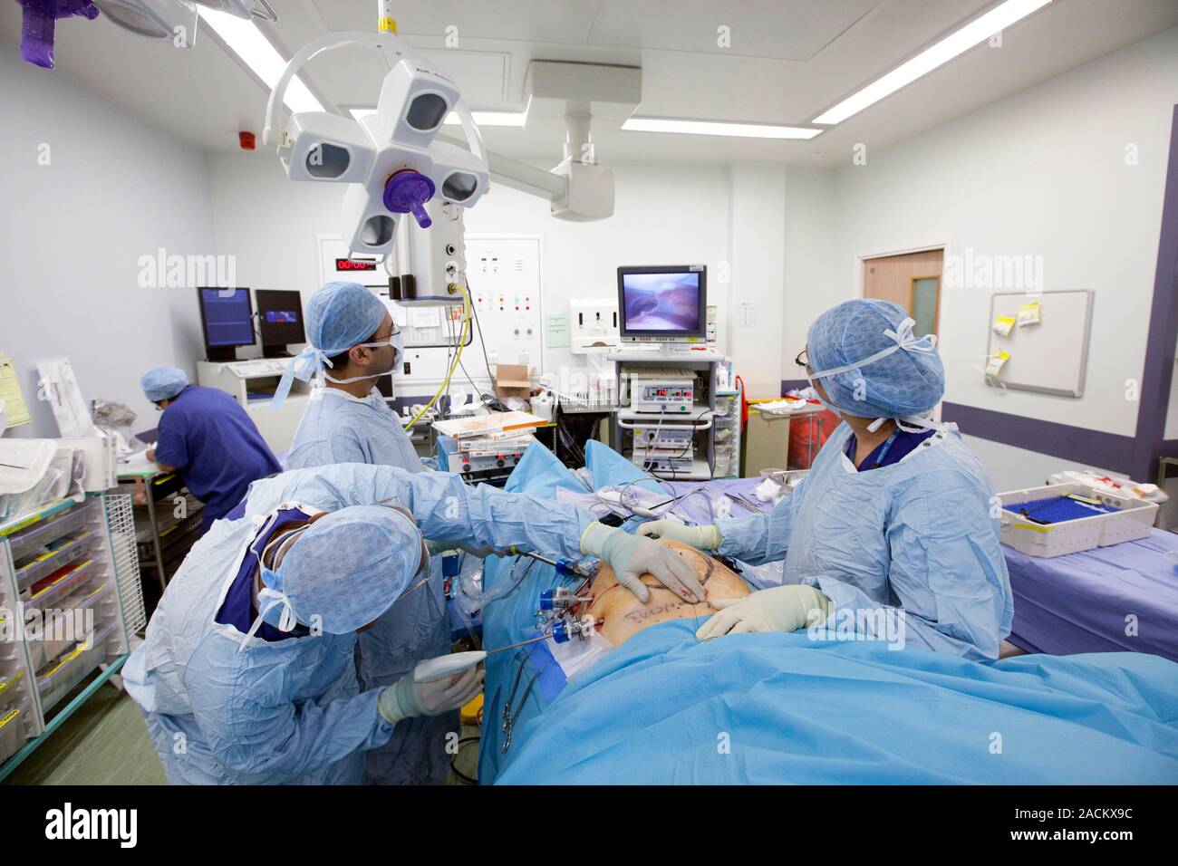 Surgeons using laparoscopes (endoscopes) to repair an incisional hernia ...