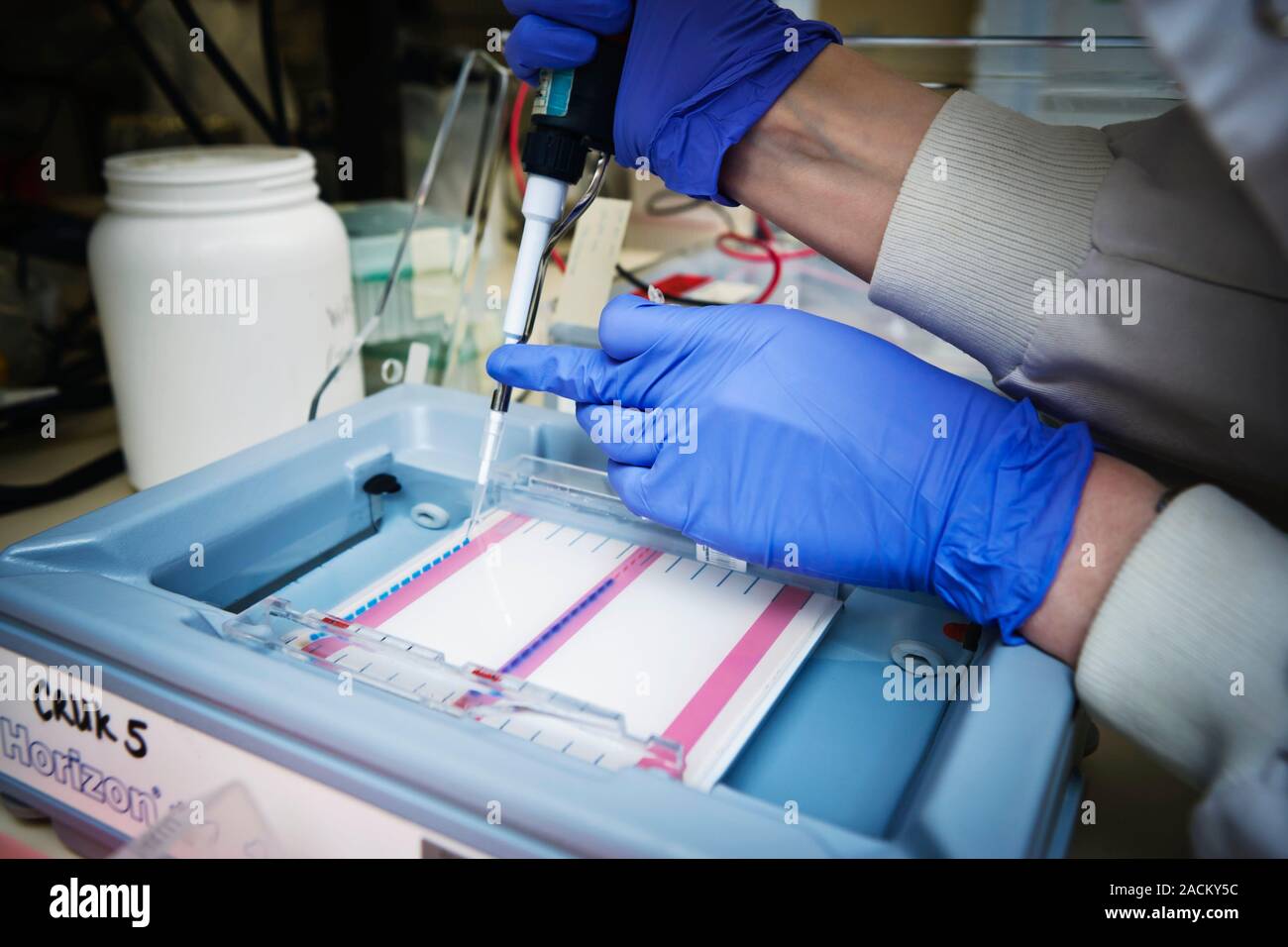 Cancer research laboratory. Researcher using a pipette in a ...